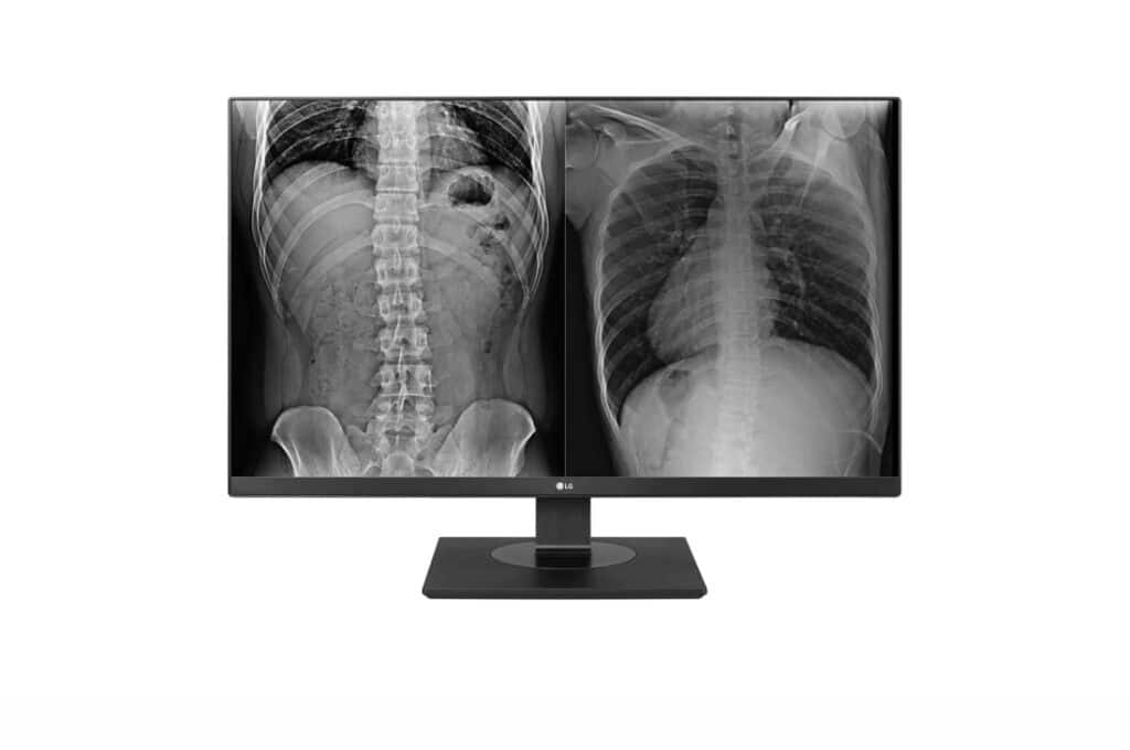LG Medical Displays | Rutledge Medical